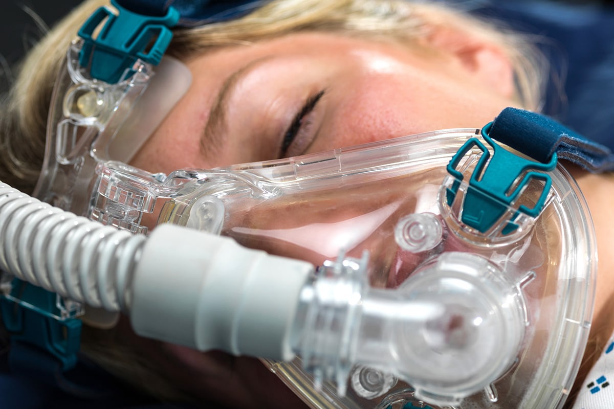 Can You Cure Sleep Apnea? | The Smile Architects