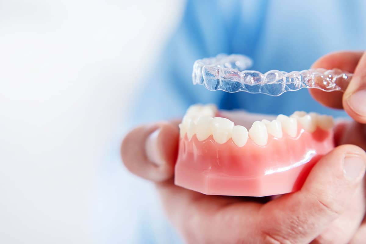 Is Invisalign Worth It? | Huntersville, NC | Smile Architects
